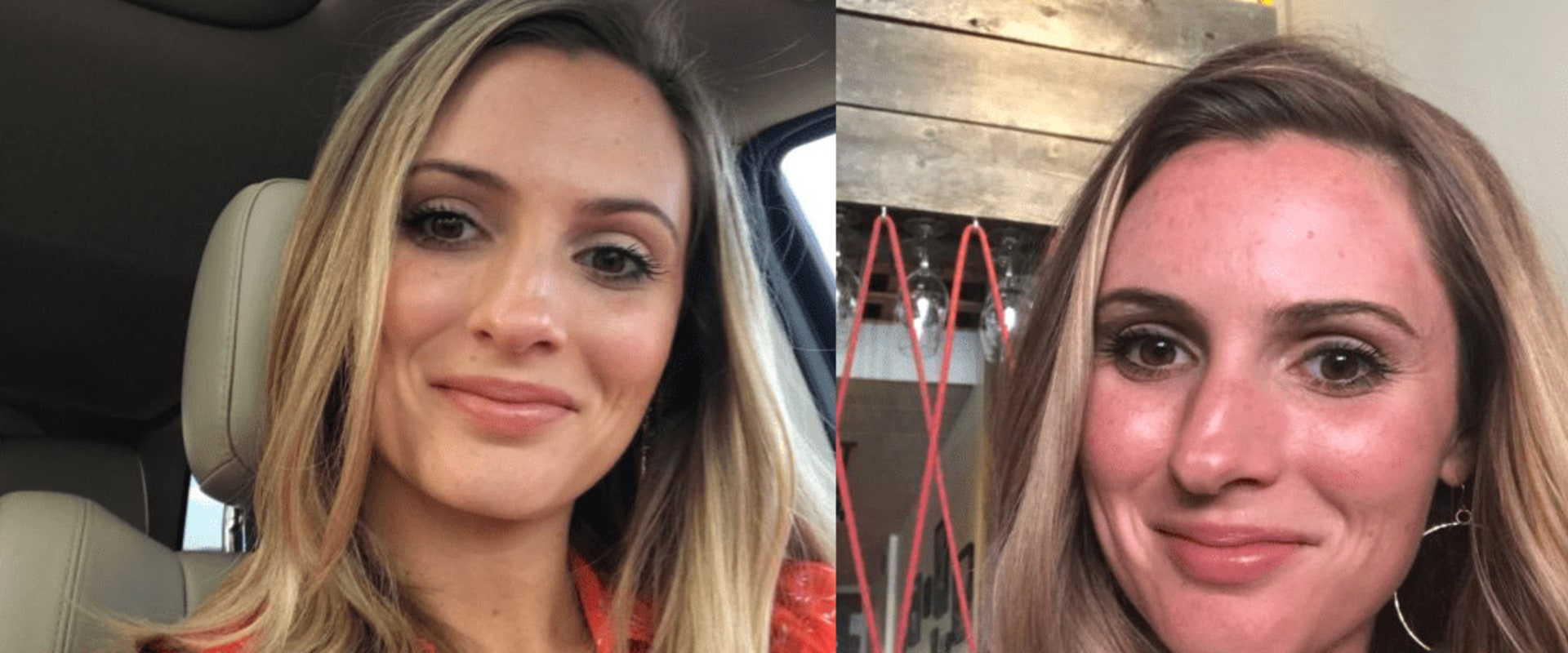 The Benefits of a Vampire Facial: Is it the Same as Microneedling?